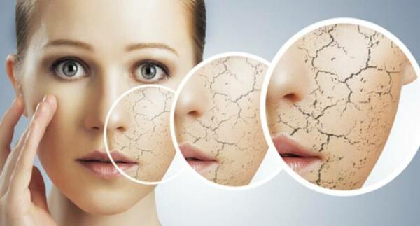 The Best Routine for Dry Skin Care | RitiRiwaz